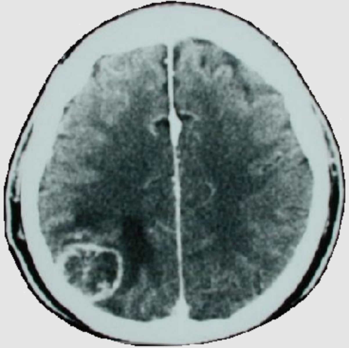 Germanische Heilkunde - Akademie für Germanische Heilkunde